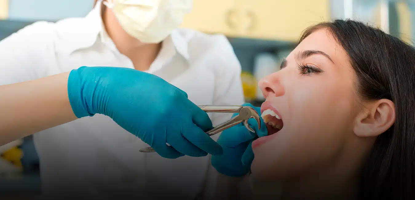 Tooth Extractions in Poway, CA | Pomerado Family Dental